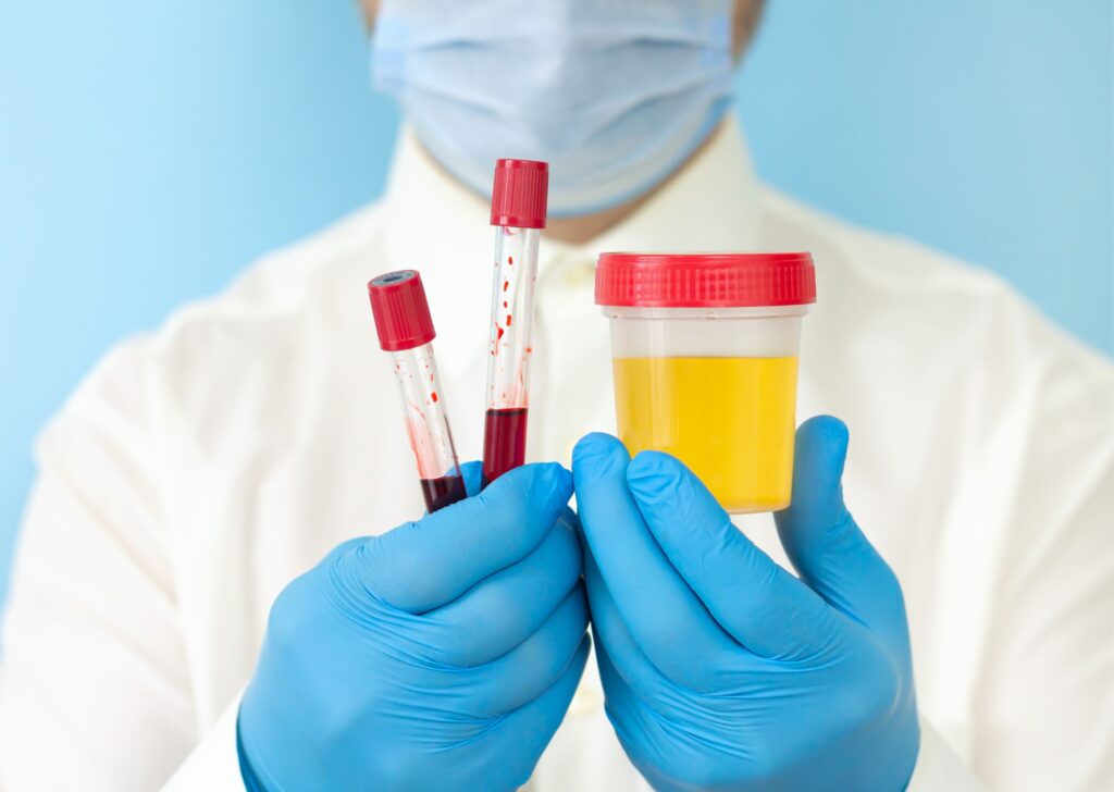 Ultimate Guide on How to Use Synthetic Urine with Fake Penis
